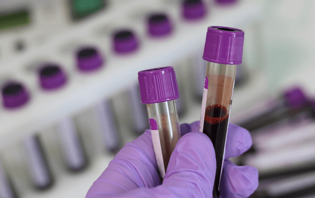 Guides – SiPhox Health